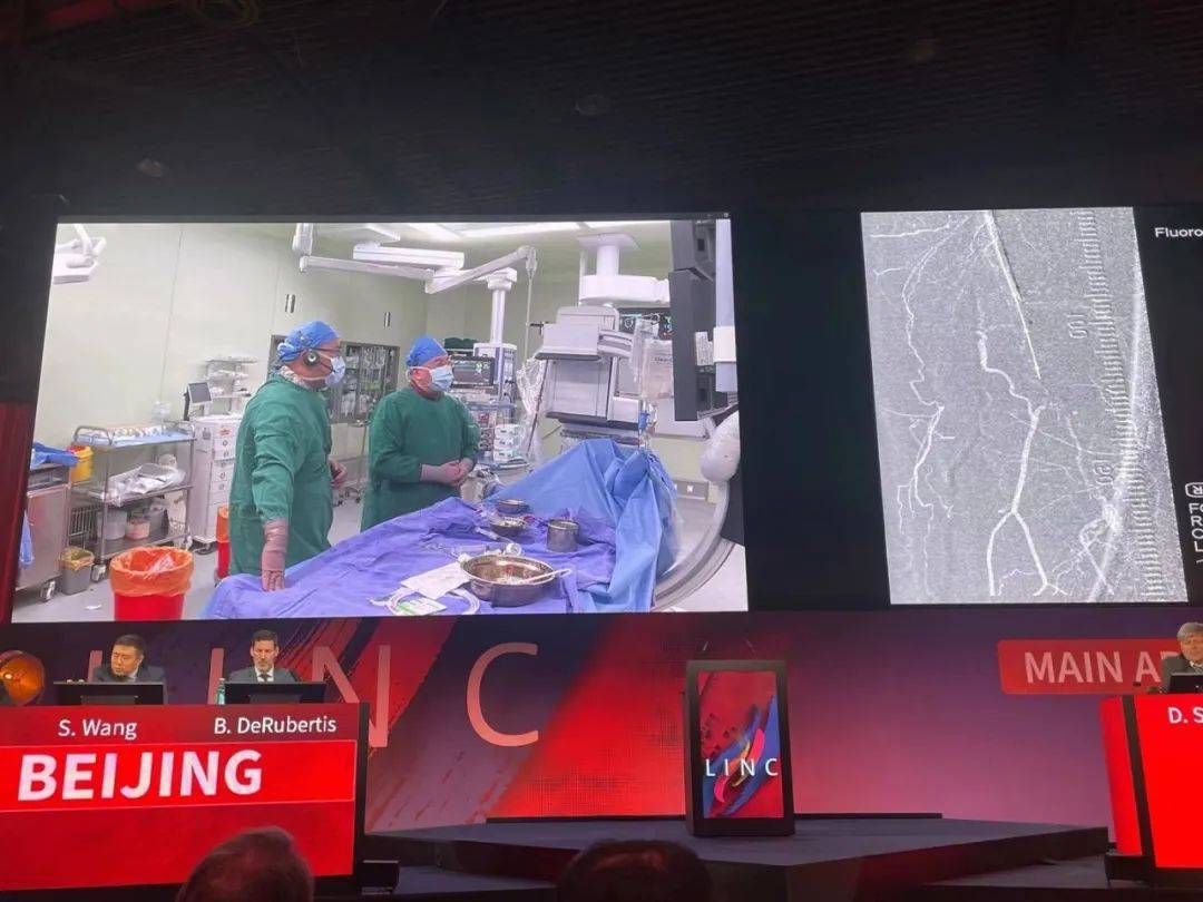 LINC 2024 手术直播｜唐小斌教授团队：1例DAART治疗股浅动脉闭塞病例_病变_造影_斑块