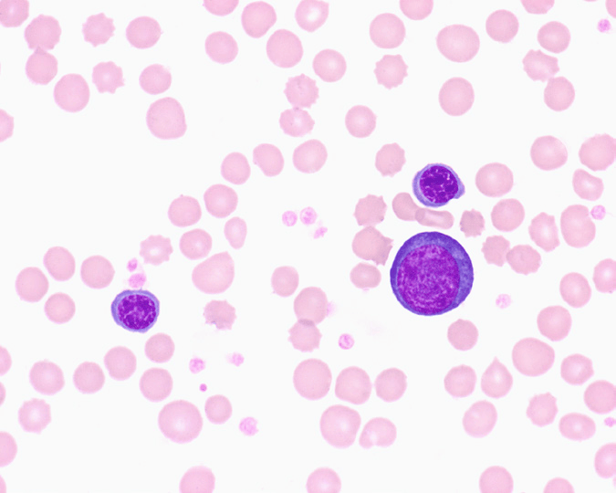 红细胞形态评估：总结有核红细胞的5种分类与临床意义_细胞核_细胞质_反应
