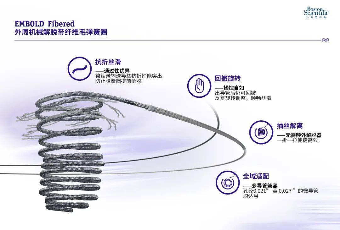 灵动至简｜EMBOLD Fibered外周机械解脱带纤维毛弹簧圈获国家药品监督管理局批准上市_栓塞_术者_治疗