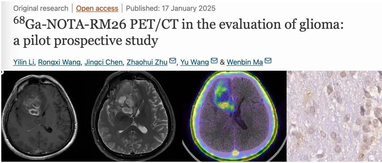 学术动态 | 北京协和神外等团队首次证实在脑胶质瘤诊断中应用68Ga-NOTA-RM26PET/CT的价值_肿瘤_染色_SUVmax