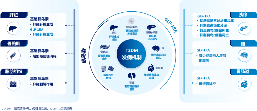 对话EASD：中外专家畅谈IcoSema“强强联合，如虎添翼”_胰岛素_治疗_临床